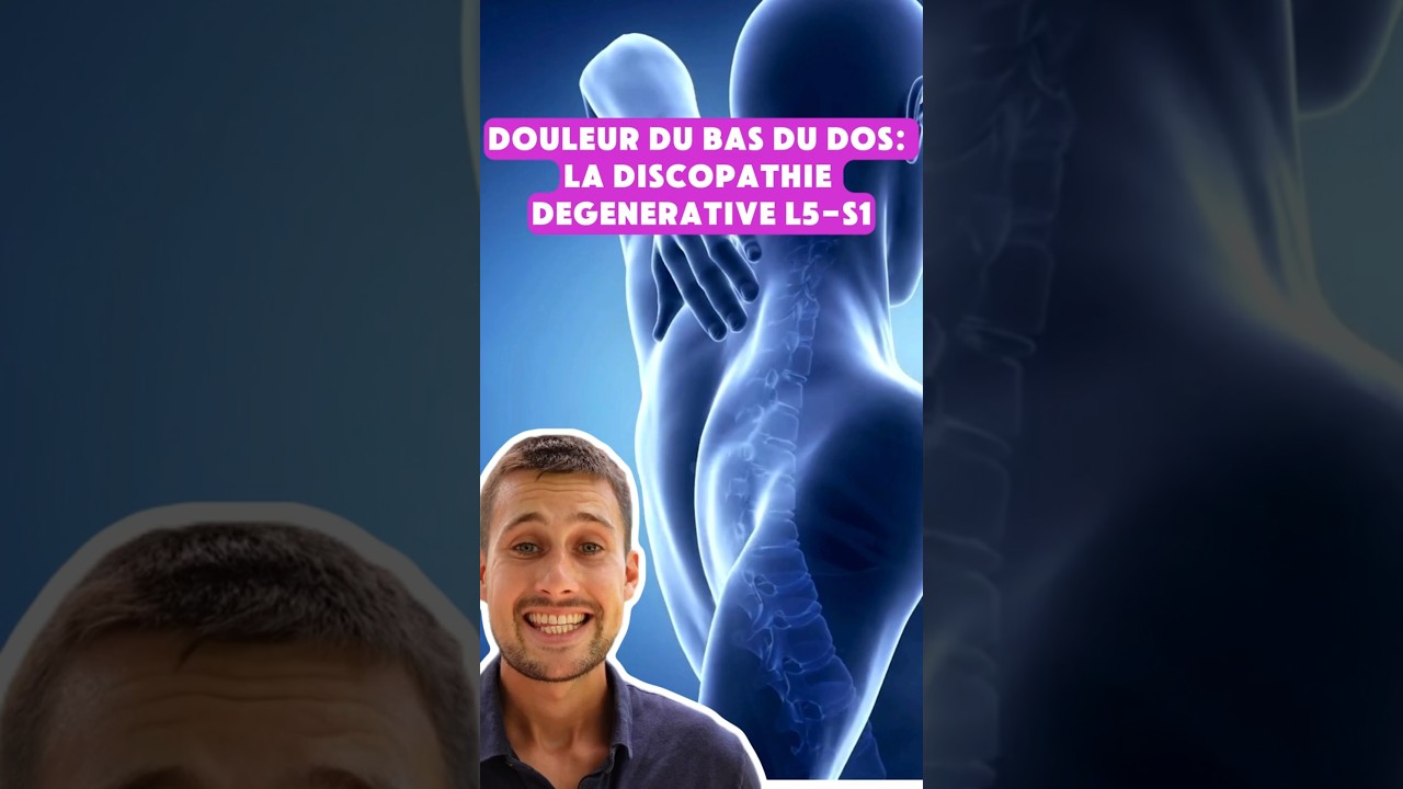 Comprendre la discopathie L5-S1 et son impact sur l'invalidité healthy ...